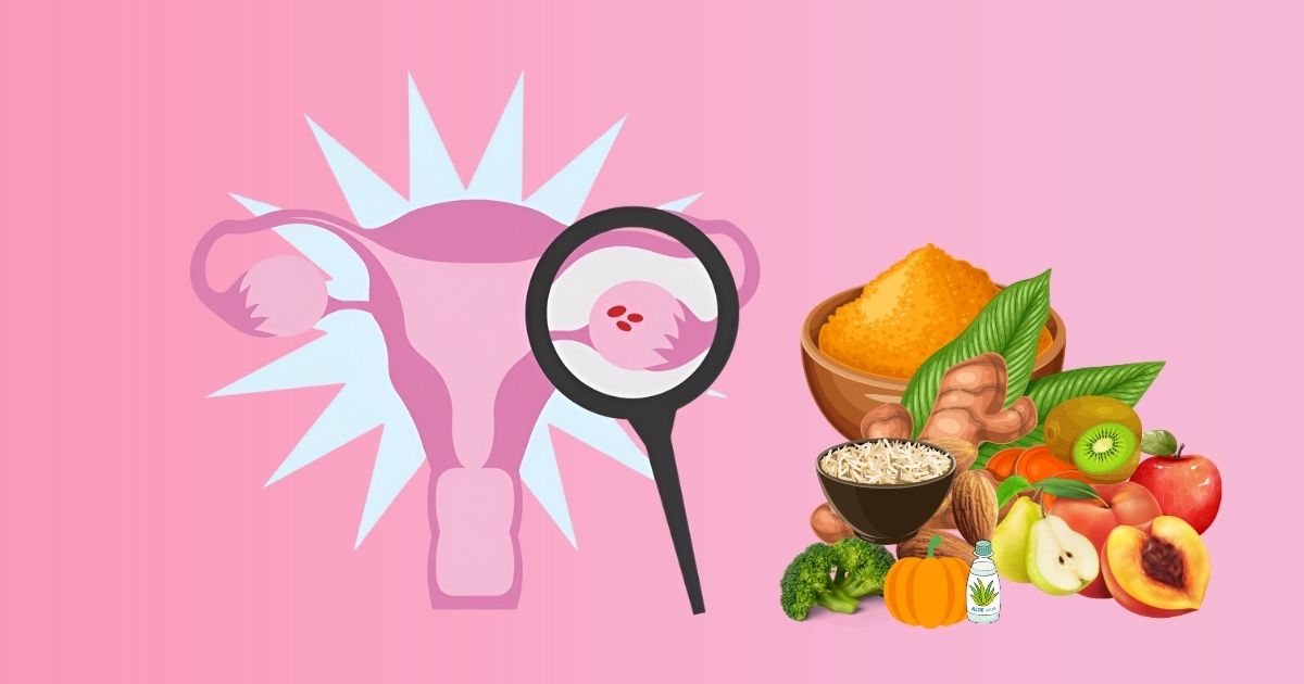 The Right Diet for Managing Ovarian Cysts The Right Diet for Managing Ovarian Cysts